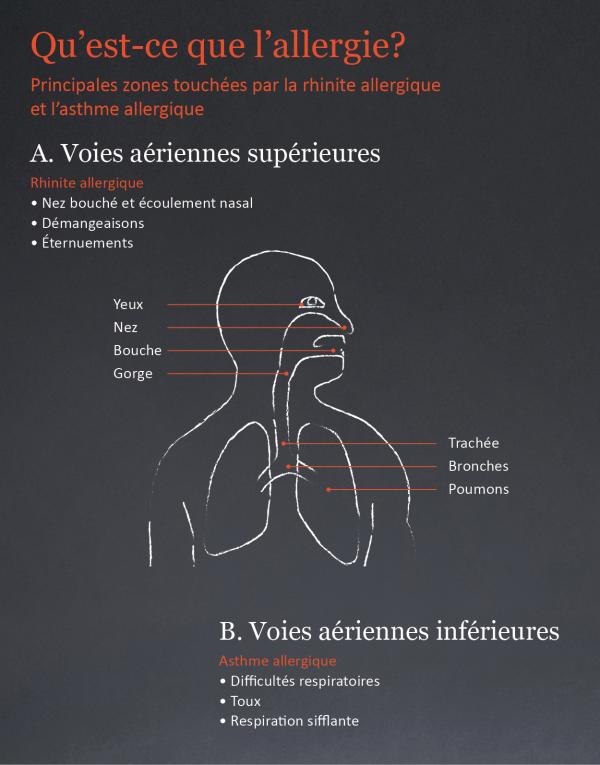 Asthme allergique | ALK BENELUX